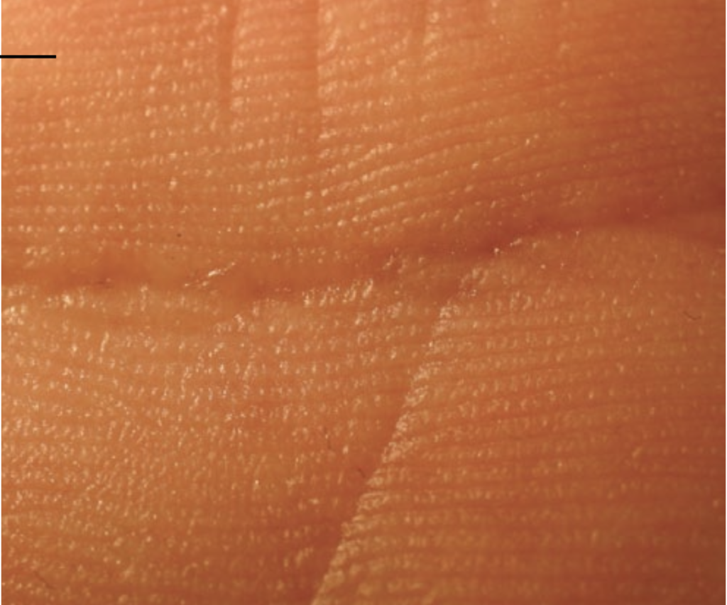 Friction Ridge Skin - Anshin Mobile Notary & LiveScan